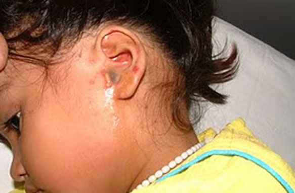 Dr. Ajay Jain - Best ENT Specialist in Preet Vihar, Top Ent Clinic in ...